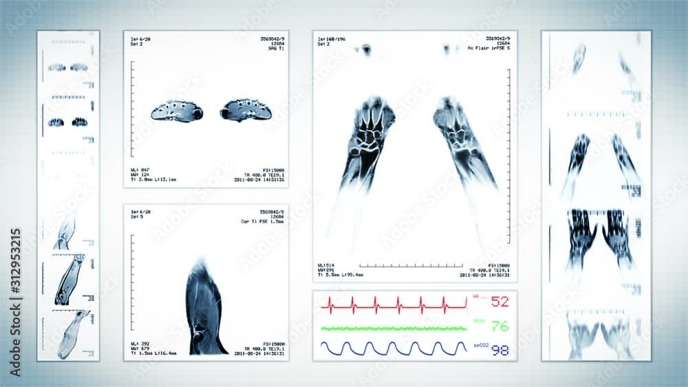 Arm MRI Scan. White. 3 videos in 1 file. Animation showing top, front ...
