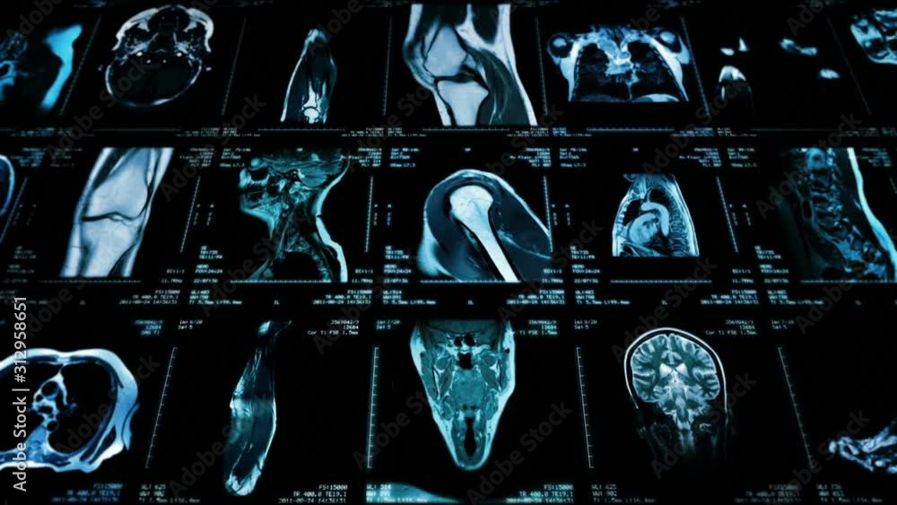 Multiple MRI video wall. Black and white. Loopable. Lateral dolly. 2 ...