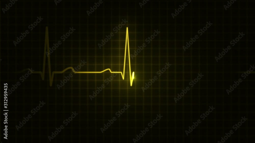 ANIMATION DESIGNED AND CREATED BY ME FROM SCRATCH.Electrocardiogram ...