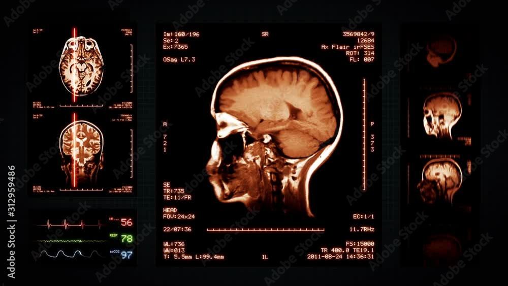 Brain, Knee and Neck MRI Scan. Amber. 3 videos in 1 file. Magnetic ...