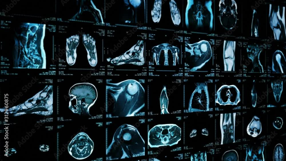 Vidéo Stock Multiple MRI video wall. White and Black. Loopable. Lateral ...