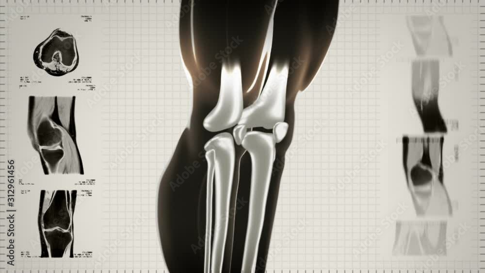 Highly detailed knee scan. Loopable. Black/white. White background. MRI ...