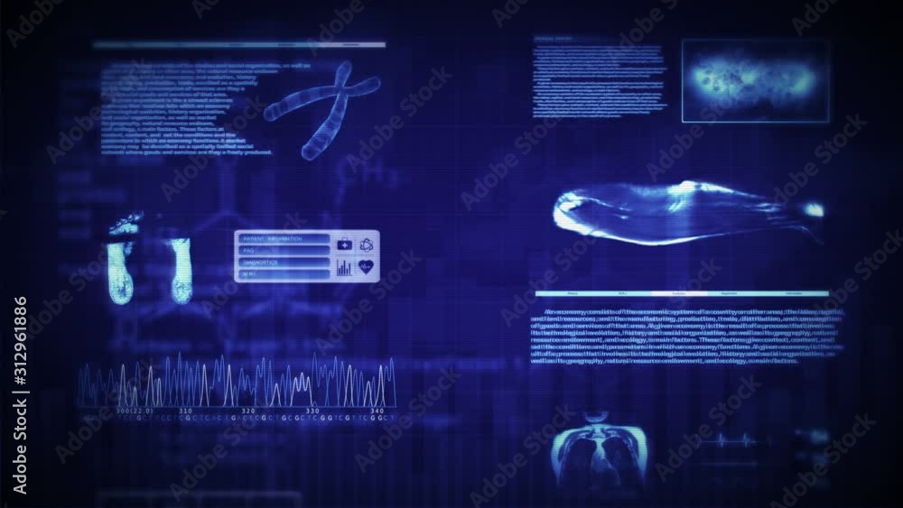 MRI interface. Loopable. Frontal view. 4 videos in 1 file. Multiple MRI ...