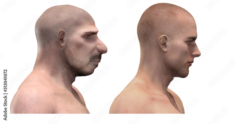 Neanderthal vs modern human Stock Illustration | Adobe Stock