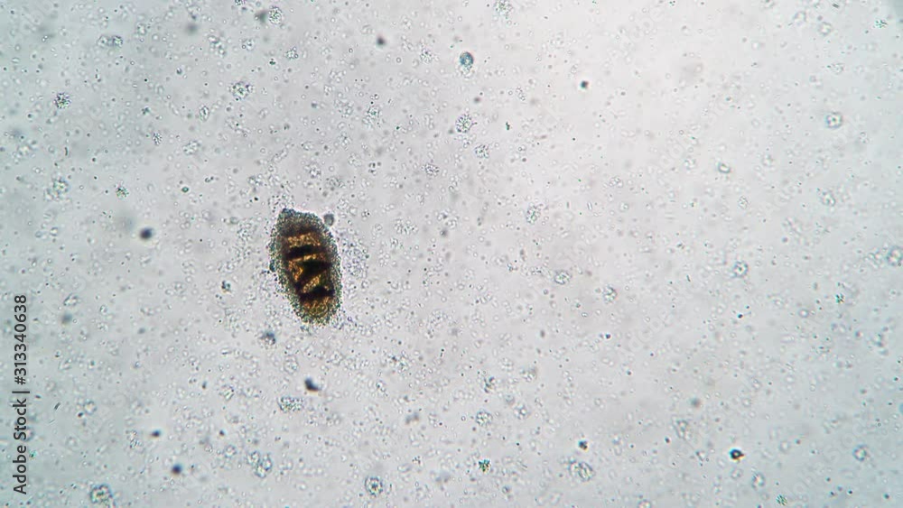 A large colony of micro-organisms and scavengers eat a dead body. Theme ...