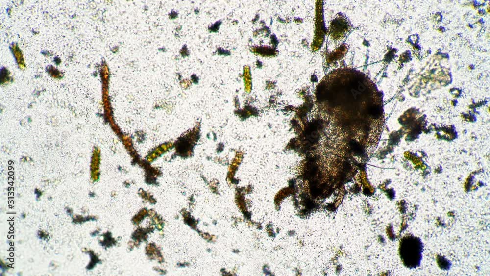 A colony of bacteria and microorganisms eats a dead dust mite. Theme of ...