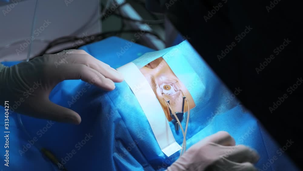 Laser vision correction. A patient and team of surgeons in the ...