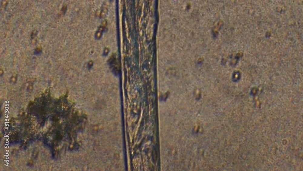 Microscopy of parasite worm nematode (Strongyloides stercoralis ...