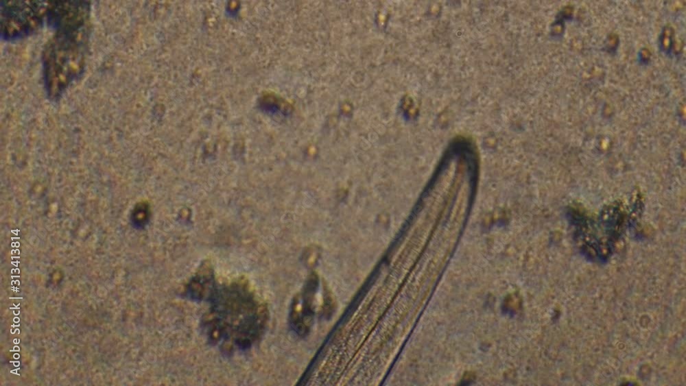 Microscopy of parasite worm nematode (Strongyloides stercoralis ...