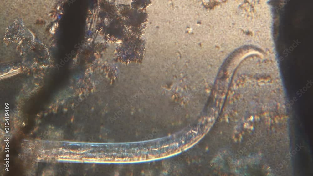 Microscopy of parasite worm nematode (Strongyloides stercoralis ...
