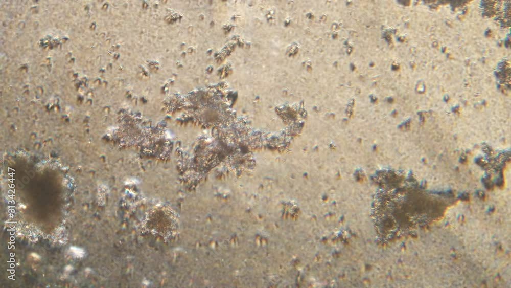 Microscopy of protozoa and small microorganisms in the water sample ...