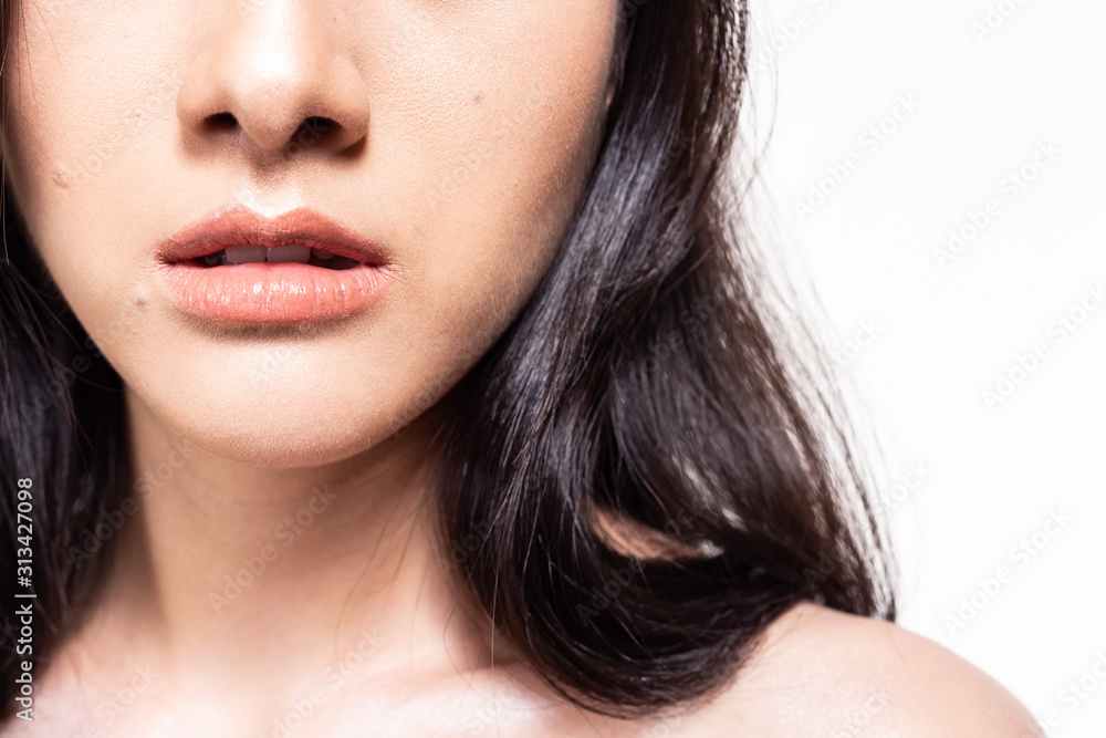 Beautiful asian woman gets pimple or acne, scar and Facial Hair on her ...