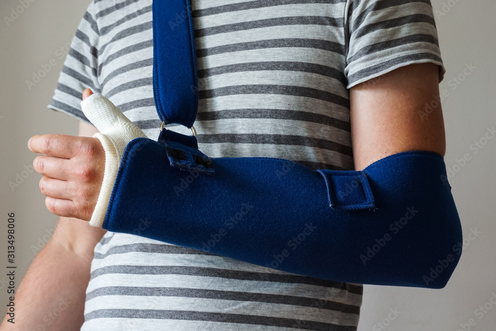 Thumb Spica Splint Plaster