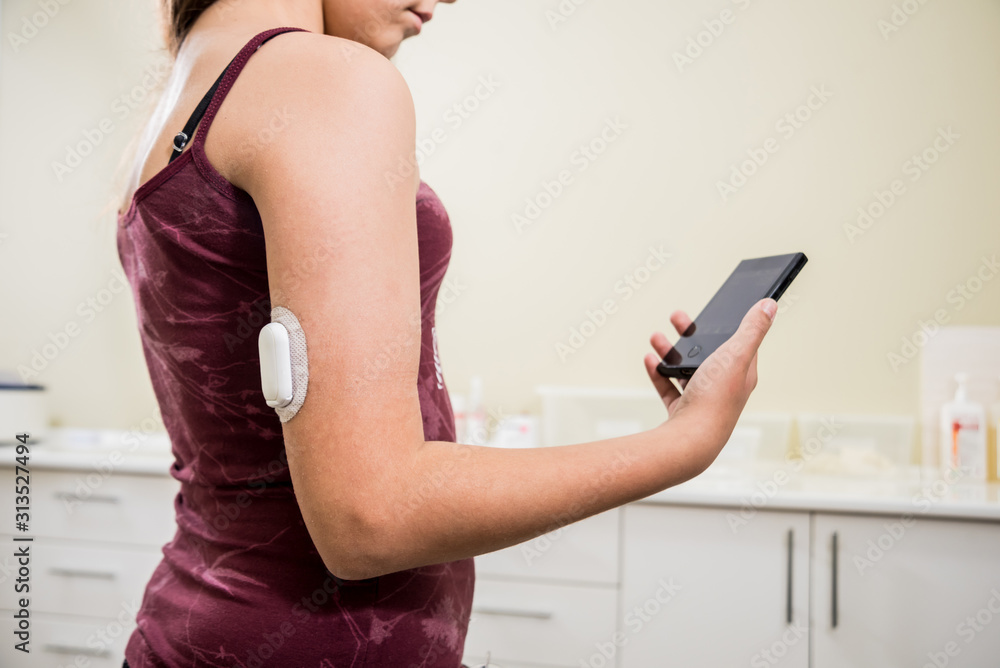 Medical device for glucose check. Continuous glucose monitoring pod ...