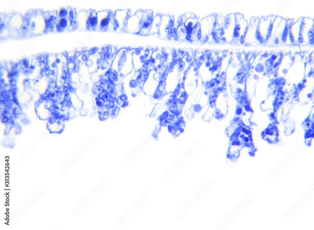 Longitudinal section of the Hydra under the microscope (Hydra L.S ...