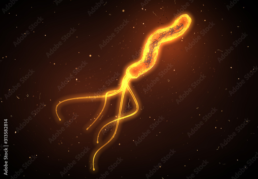 Helicobacter pylori bacterium causing peptic ulcer disease, gastritis ...