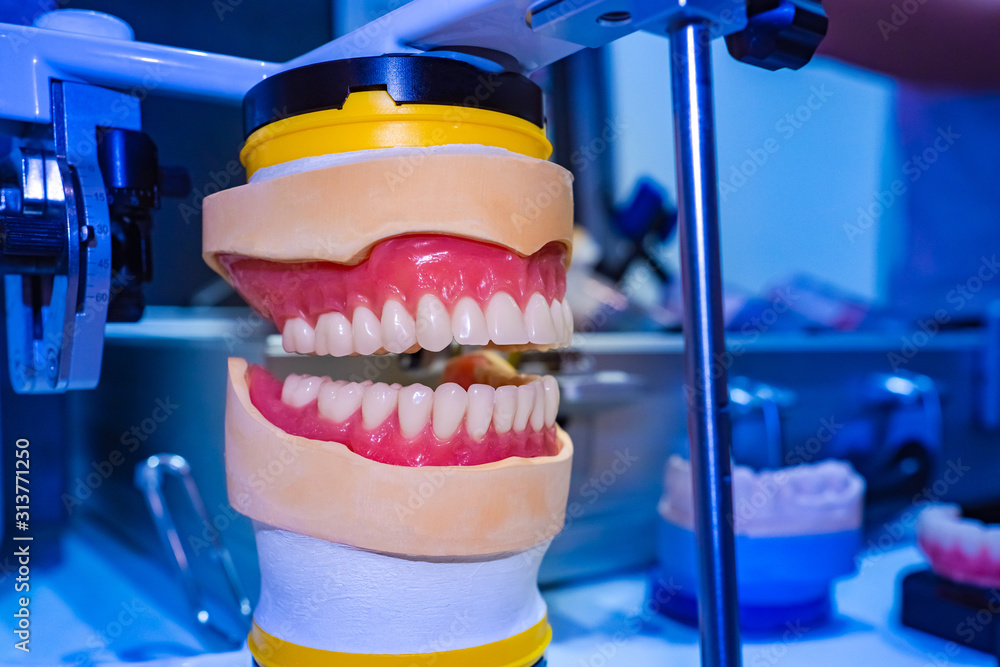 Teeth. Realistic model of the jaw of a man. Work as an orthodontist ...