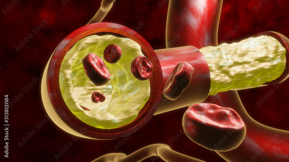 3D rendered illustration of arteries and arterioles transport ...