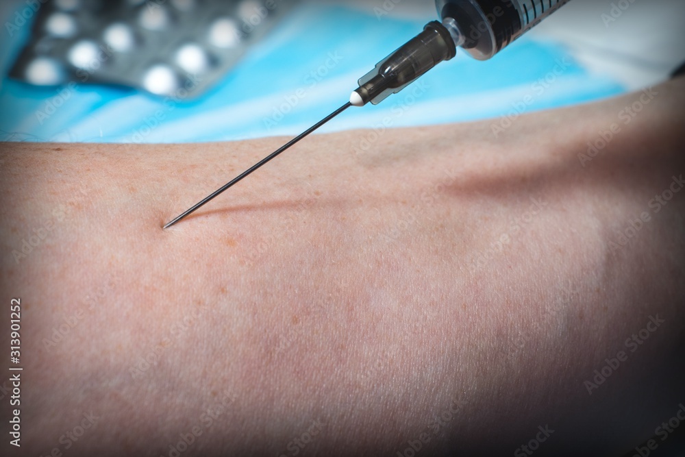 The Injection Of A Drug Into The Patients Arm With A Syringe Needle For Injection Close Up