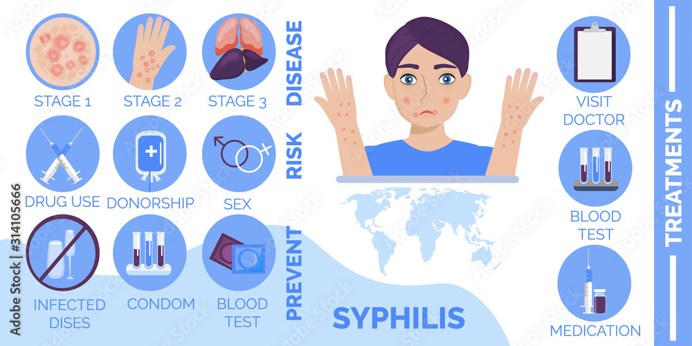 Syphilis disease, consequences, stages infographic for infected man is ...