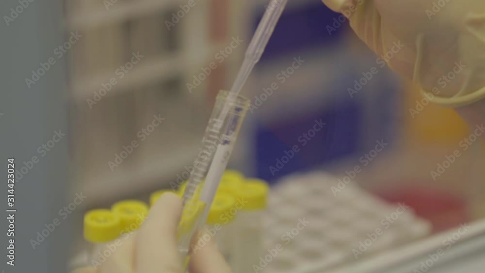 Lab technician pipetting samples with reagents in vitro, laboratory ...