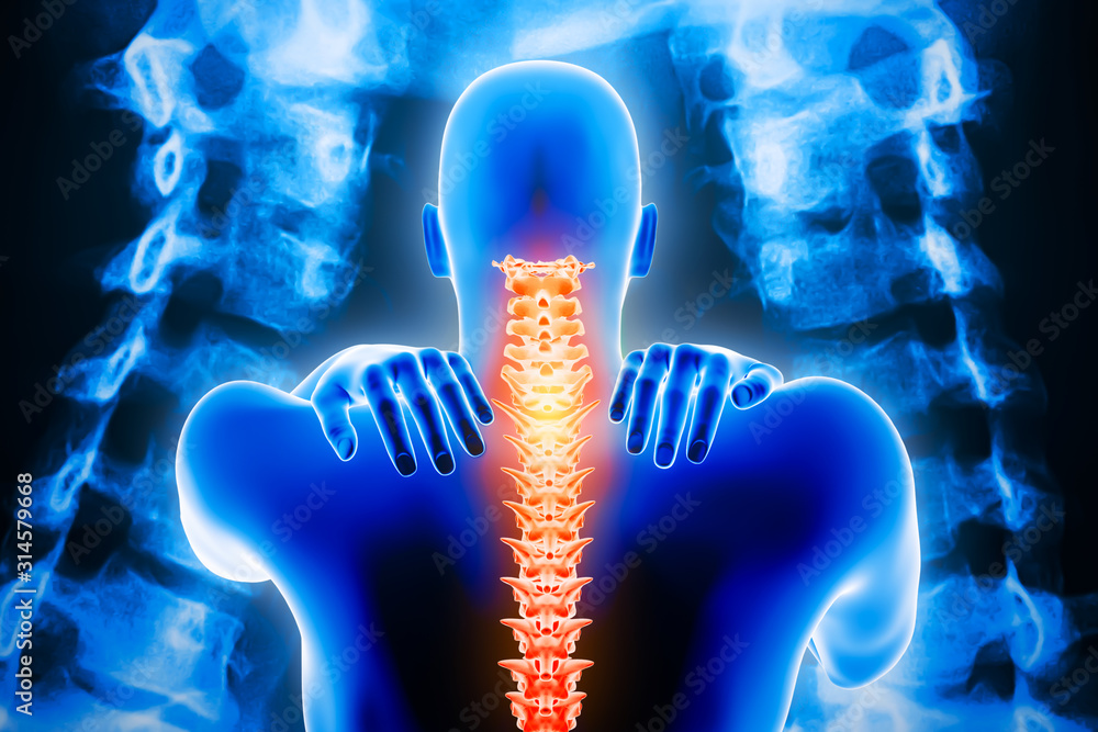 Man back body with spine and x-ray vertebrae imagery in the background ...