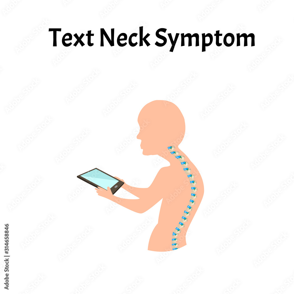 Improper posture symptoms. Text Neck Syndrome. Spinal curvature ...