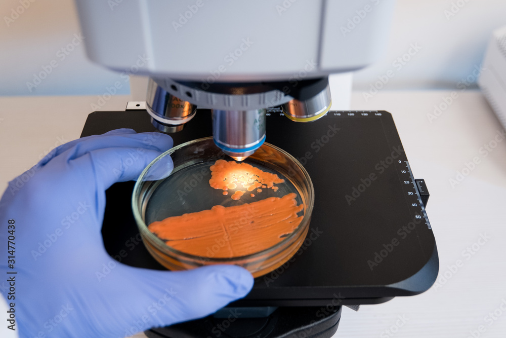 Examine bacteria on a petri dish under the microscope. Close-up doctor ...
