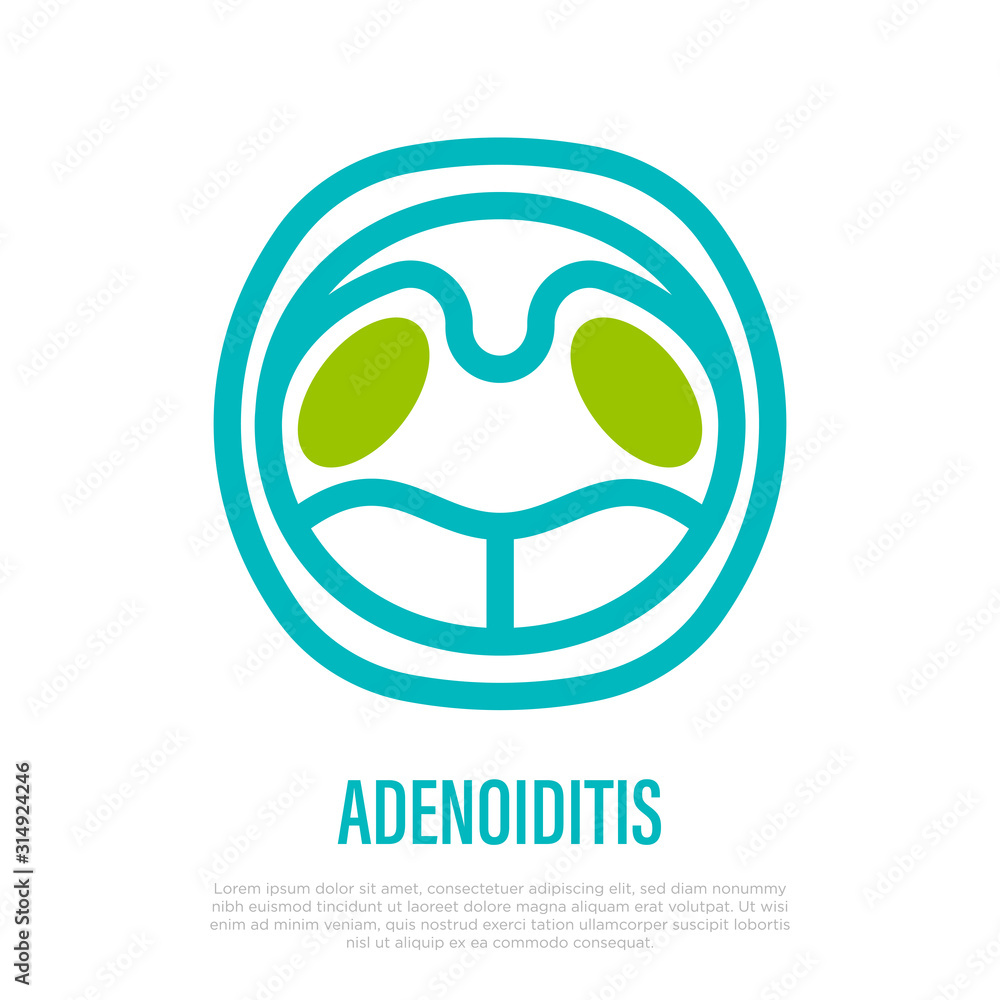 Adenoiditis: adenoids in mouth. Thin line icon. Viral tonsillitis ...