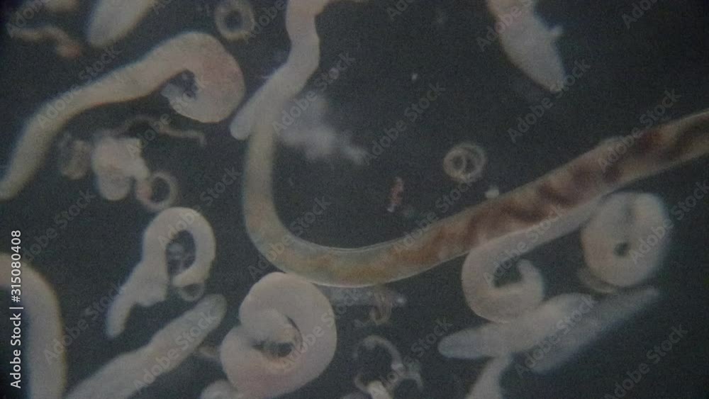 Schistosoma is a genus of trematodes, commonly known as blood flukes ...