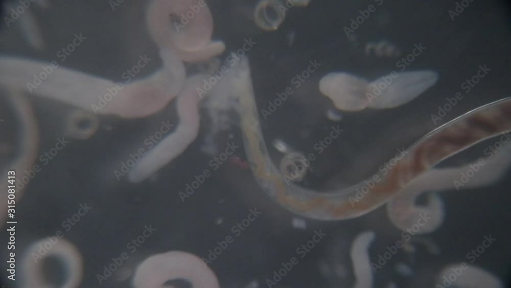 Schistosoma is a genus of trematodes, commonly known as blood flukes ...