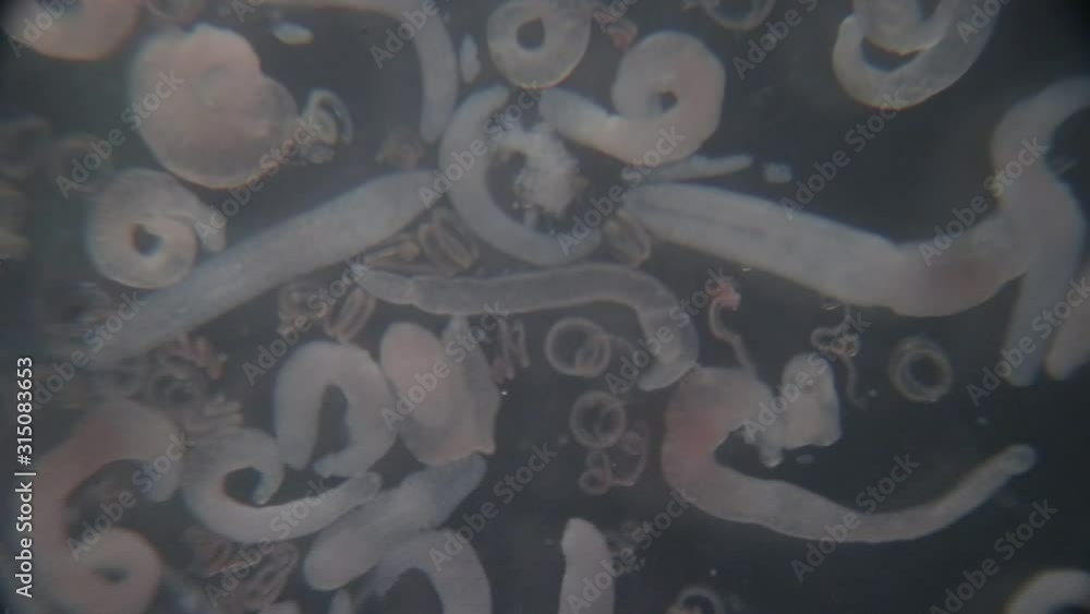 Schistosoma is a genus of trematodes, commonly known as blood flukes ...