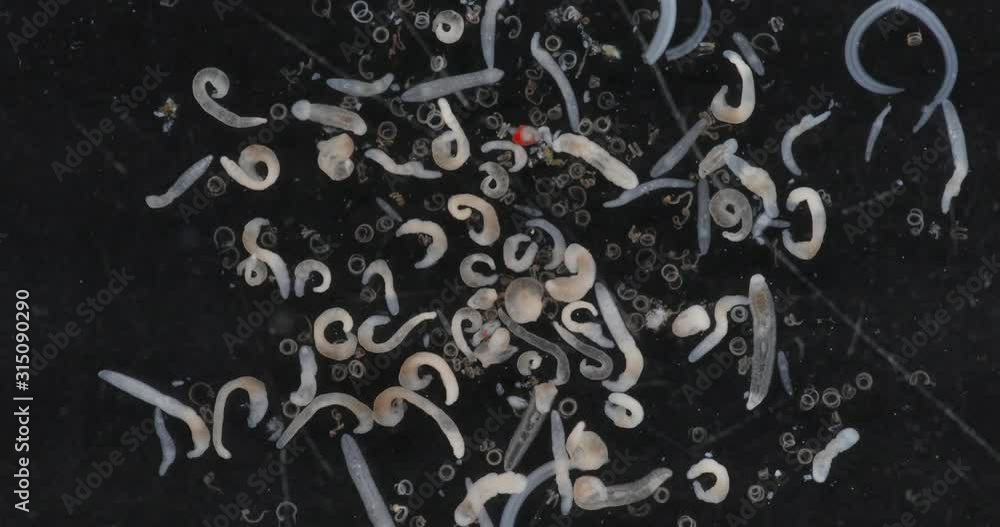 Schistosoma is a genus of trematodes, commonly known as blood flukes ...