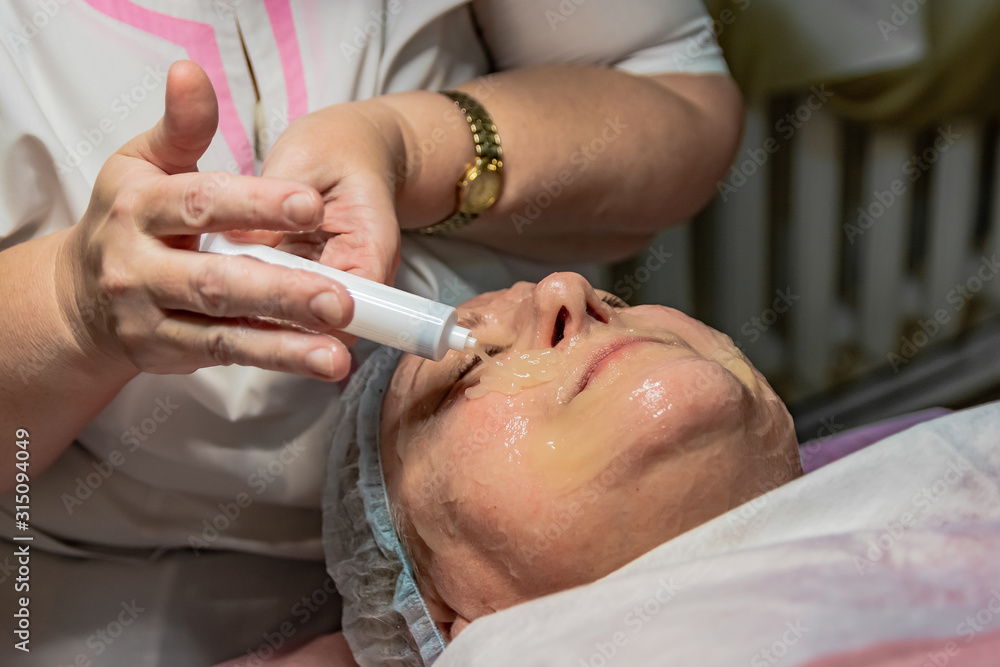 Non-invasive face carboxytherapy in a beauty salon. It is performed for ...