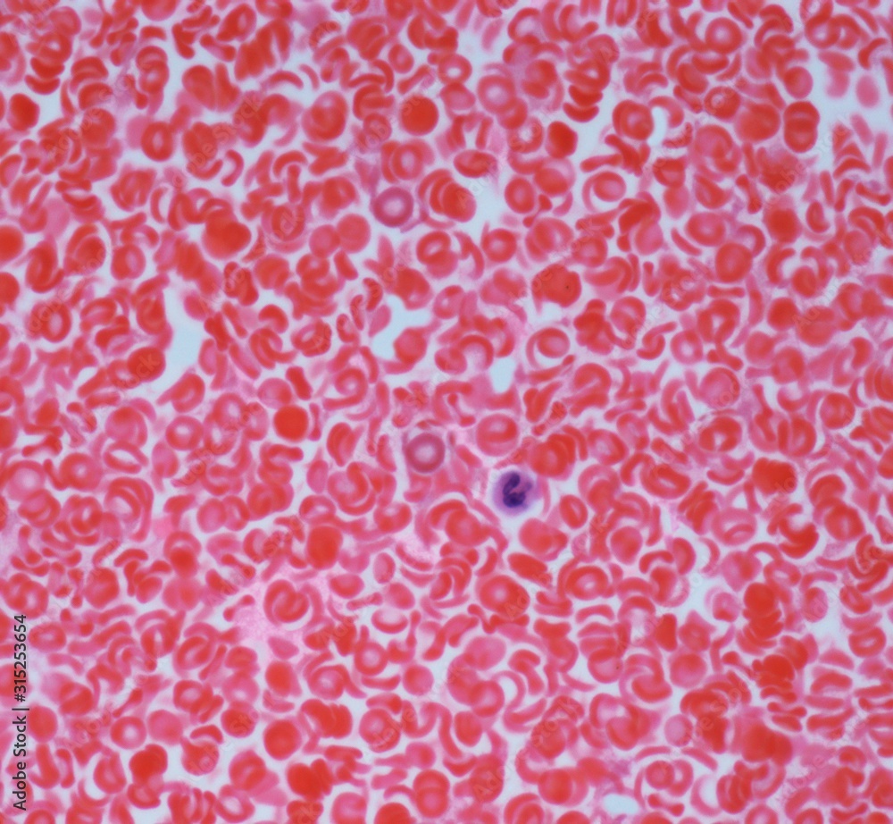 Blood, light micrograph Stock Photo | Adobe Stock