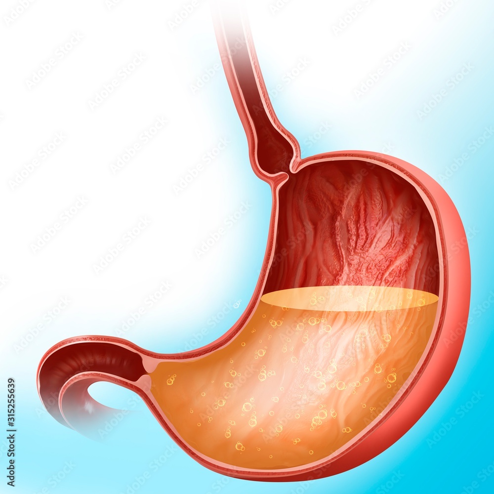 Stomach acidity, illustration Stock Photo | Adobe Stock