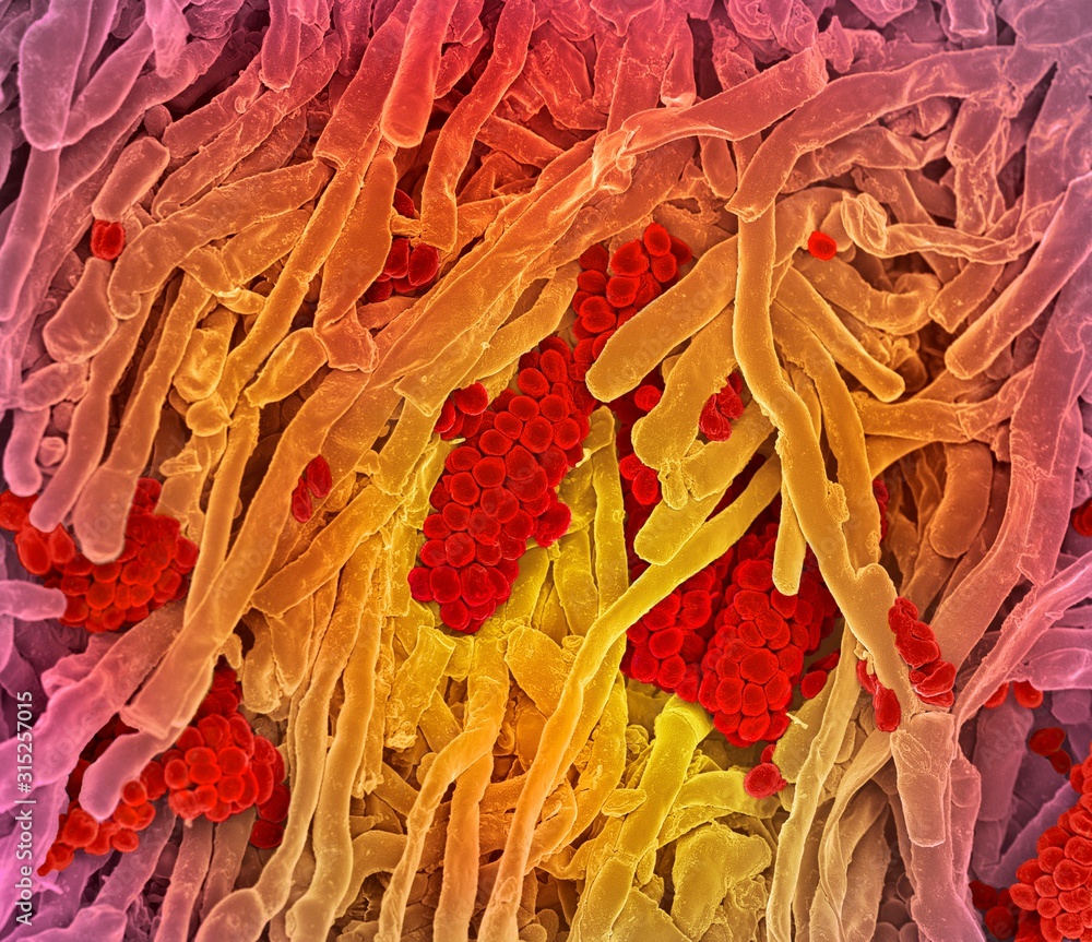 Streptomyces coelicoflavus bacteria, SEM Stock Photo | Adobe Stock