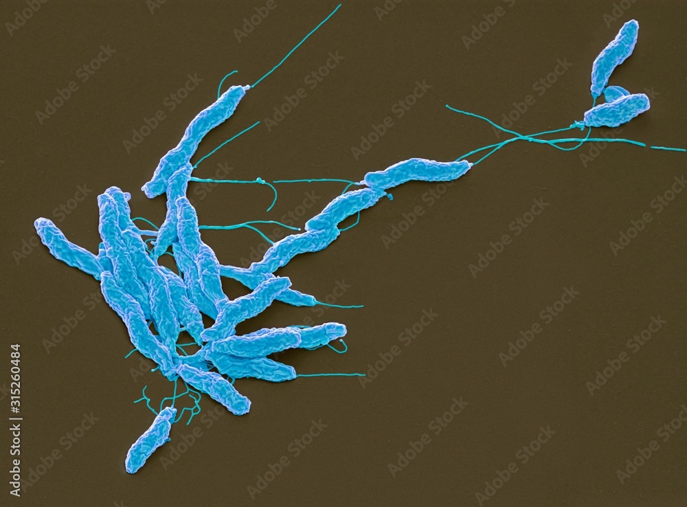 Campylobacter jejuni bacteria, SEM Stock Photo | Adobe Stock