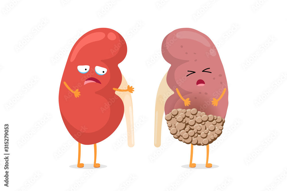 Healthy and sad suffering sick kidney with cancer characters. Human ...