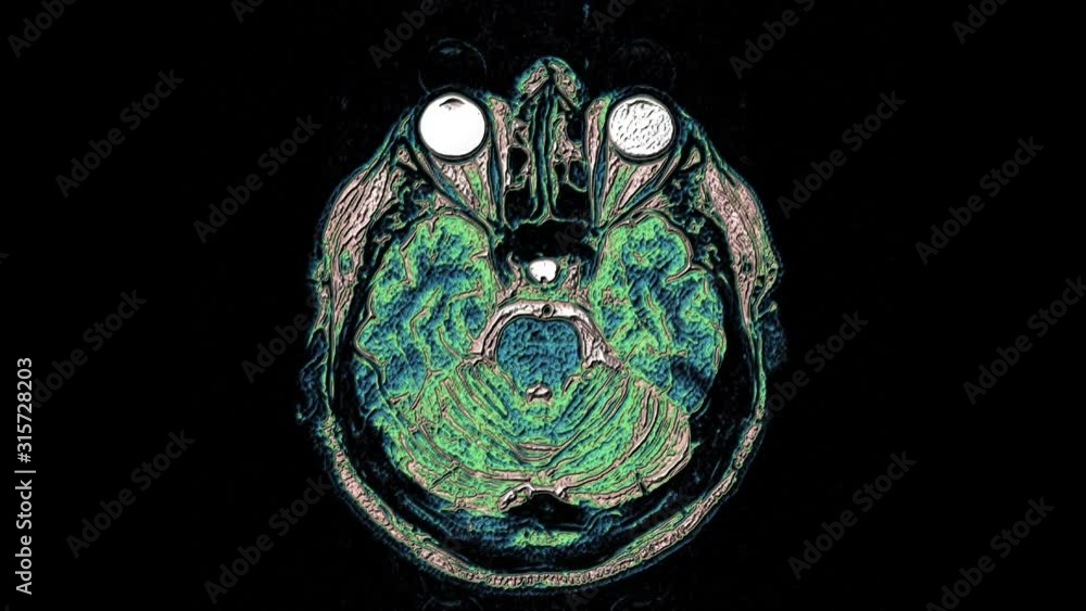 Bulk multicolored MRI scans of the brain and head to detect tumors ...