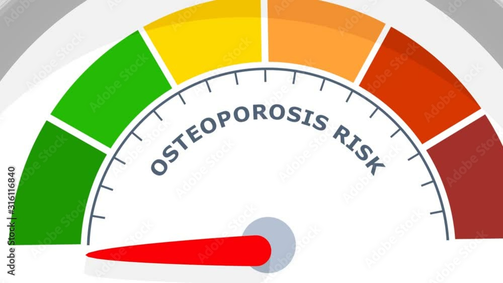 Color scale with arrow from green to red. Osteoporosis risk measuring ...