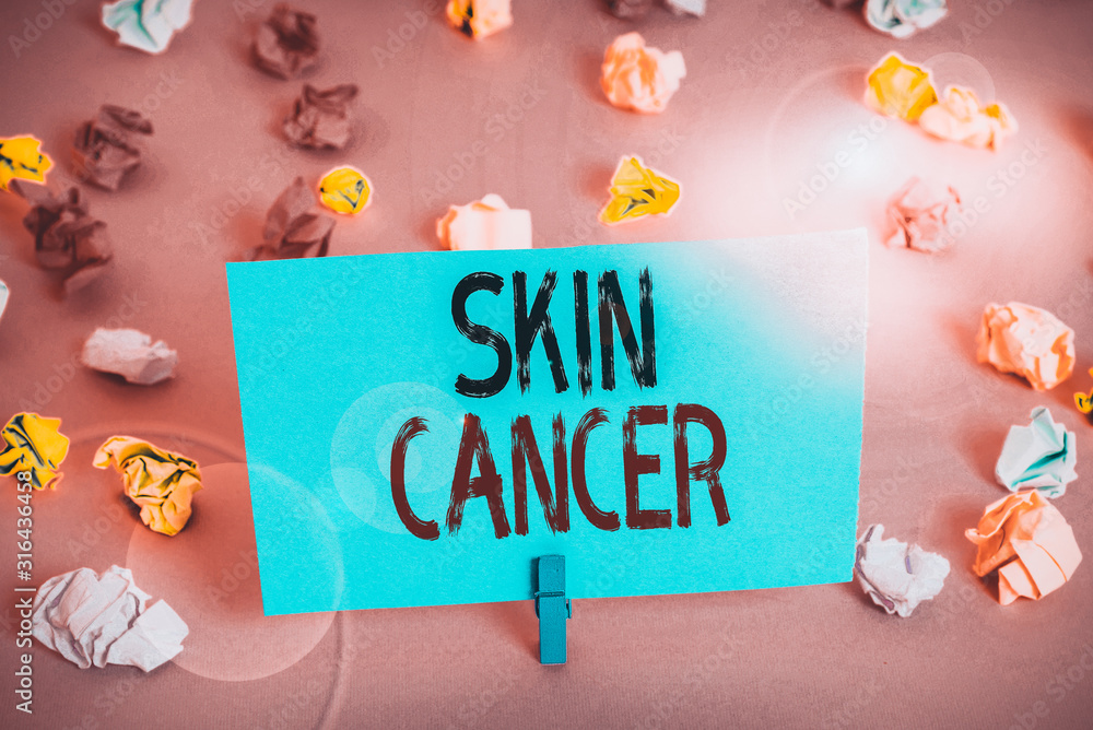 Handwriting text Skin Cancer. Conceptual photo uncontrolled growth of ...