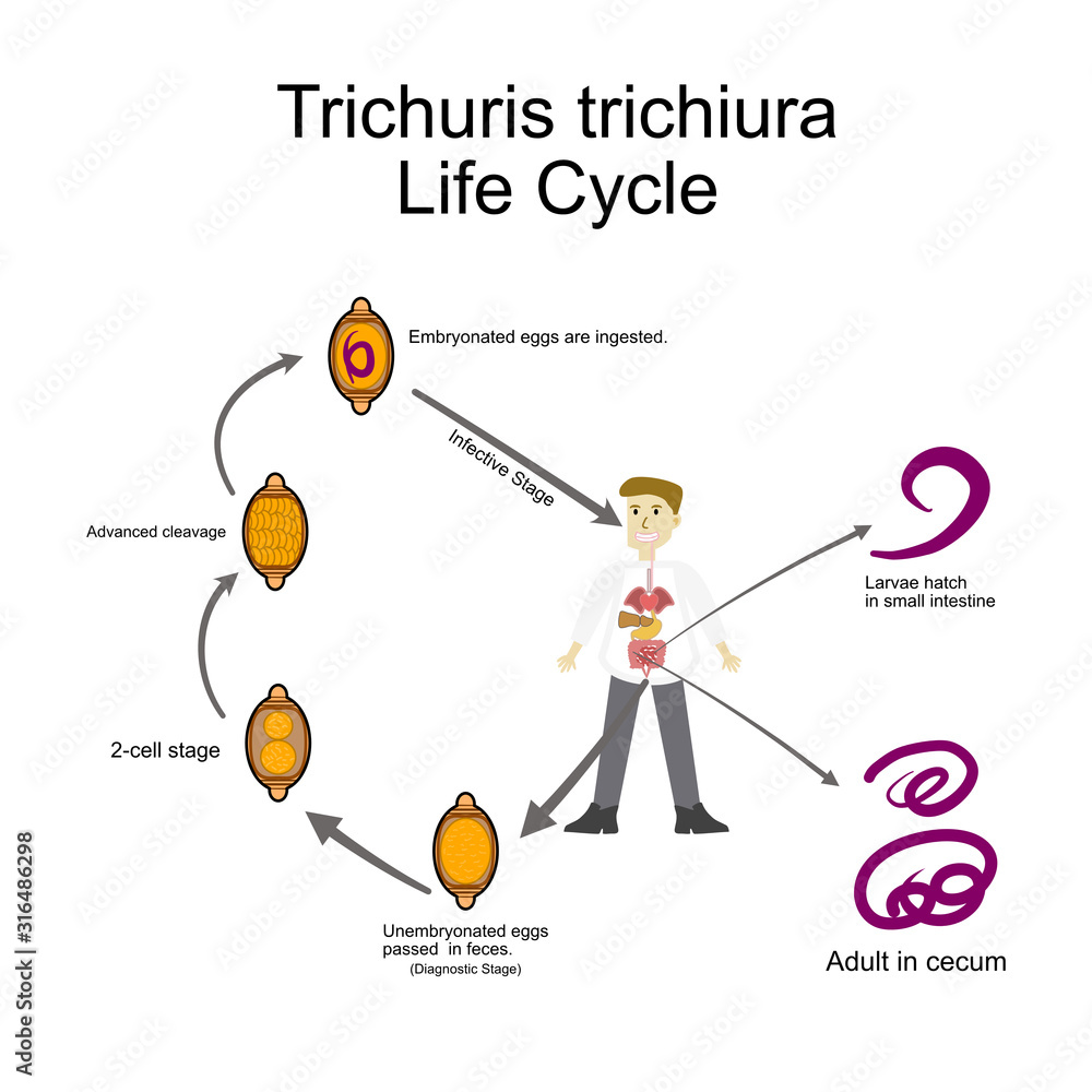 Vetor do Stock: parasite, trichuris, trichuris trichiura, microscopy ...