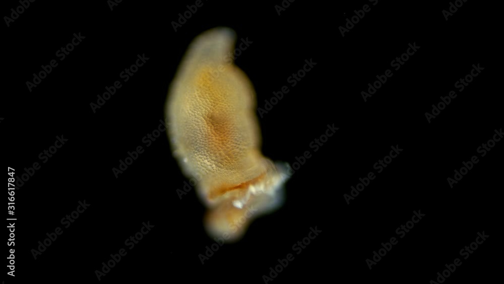 Larva of a worm at Pelagosfera stage under microscope, Sipuncula Phylum ...