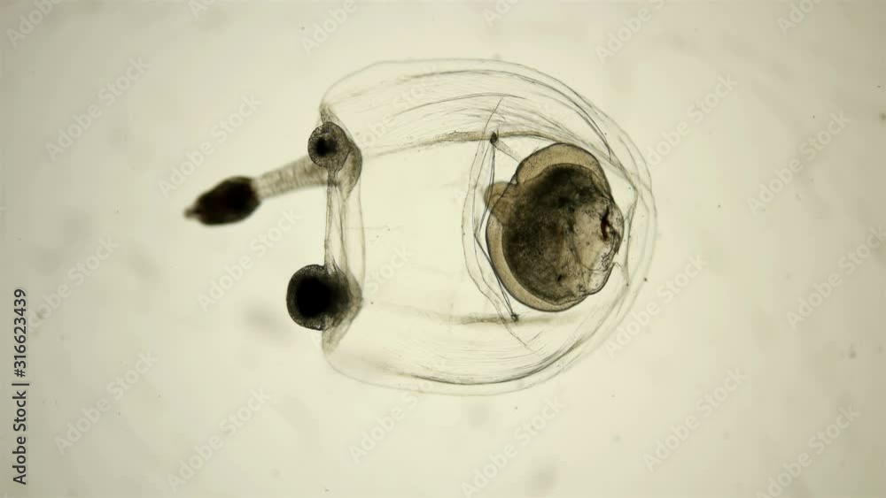 small jellyfish under a microscope, class Hydrozoa, type Cnidaria ...