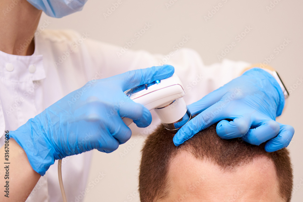 Microscopic examination of the hair and skin of the scalp. Stock Photo ...