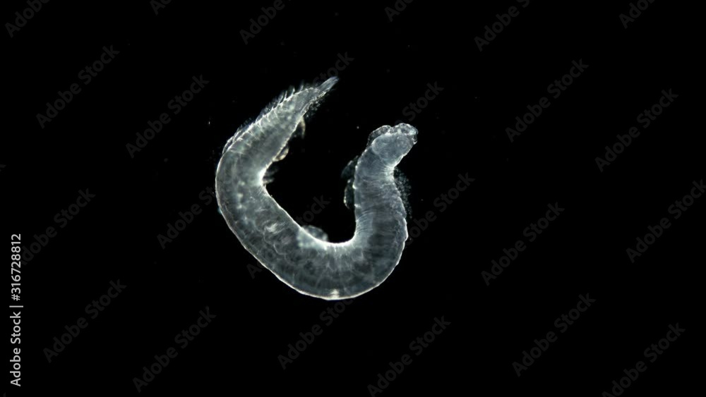 Vidéo Stock the Typhloscolex sp. worm under a microscope, class ...