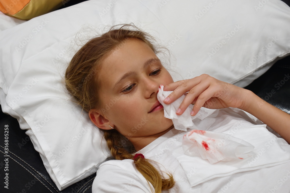 Children bleeding from the nose. Girl lying on her bed with a headache ...