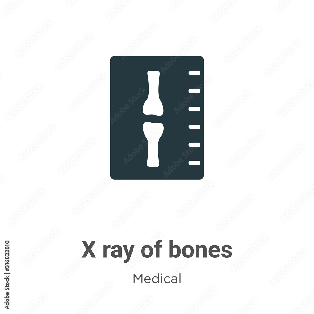 X ray of bones glyph icon vector on white background. Flat vector x ray ...