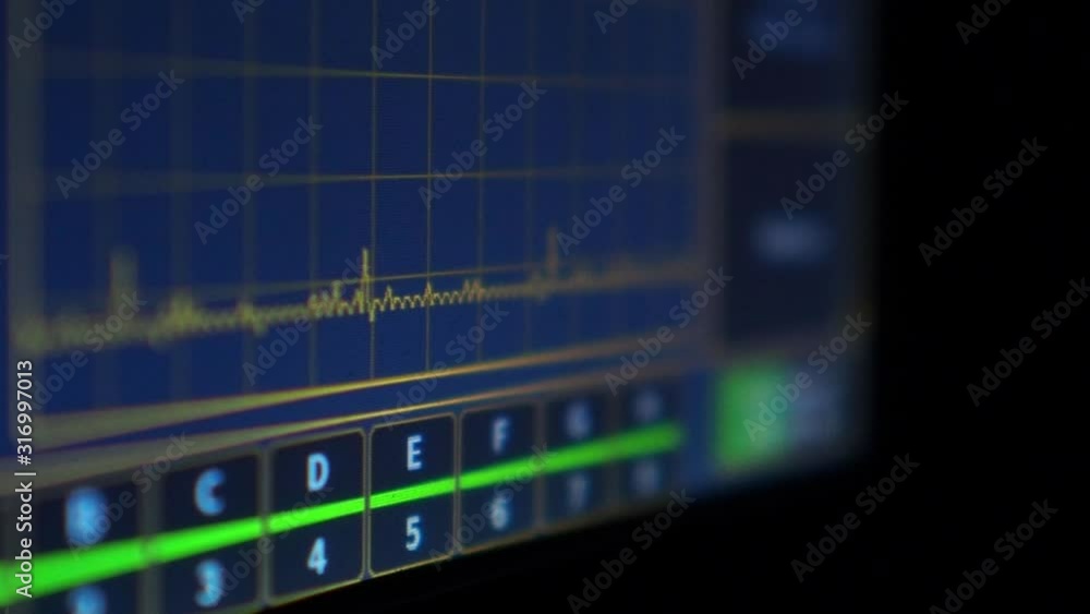 Digital graph scrolling past on a computer monitor indicating the ...